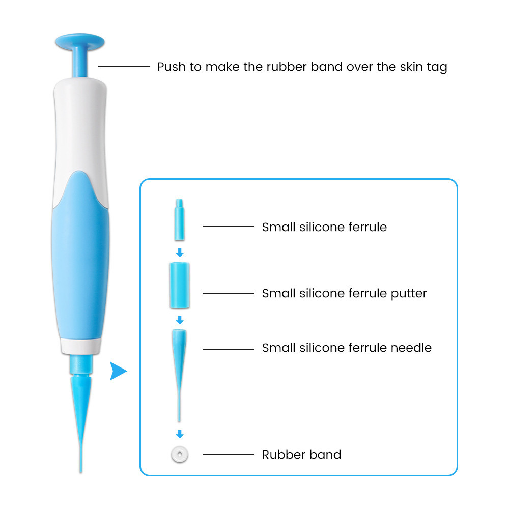 2 In1 Painless Auto Skin Tag Mole Wart Removal Kit Cleaning Tools Face ...