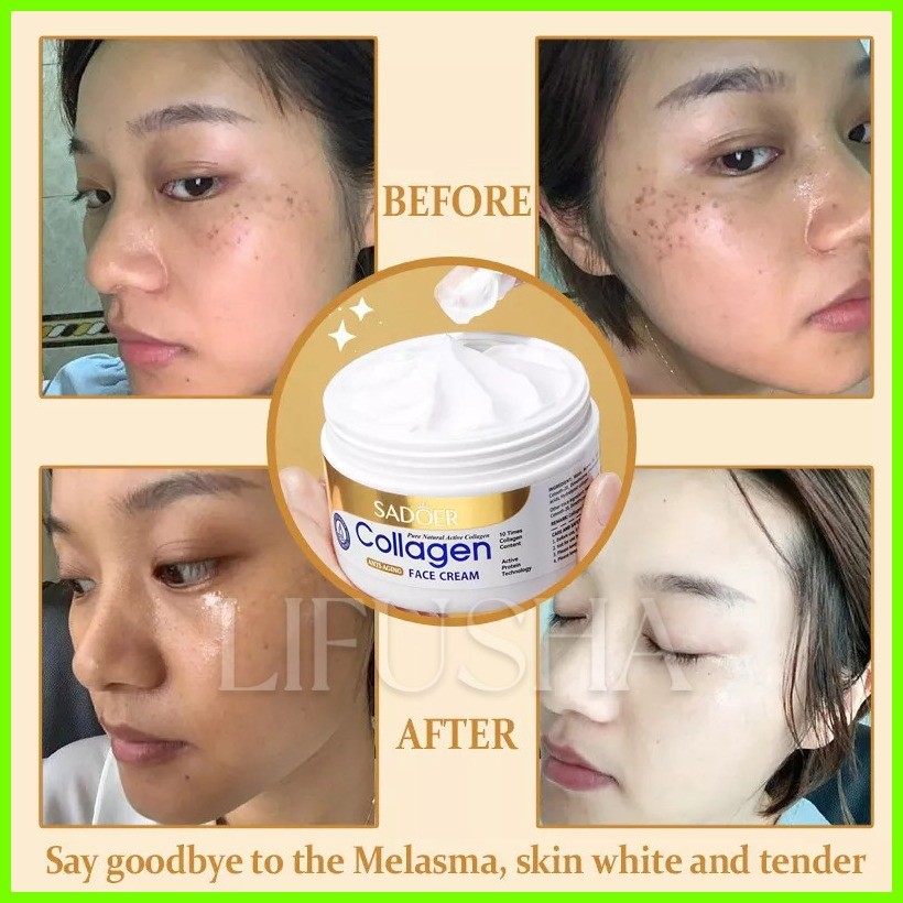 ♒ ♆ Original Collagen With Glutathione Face Cream Whitening Skin Anti ...