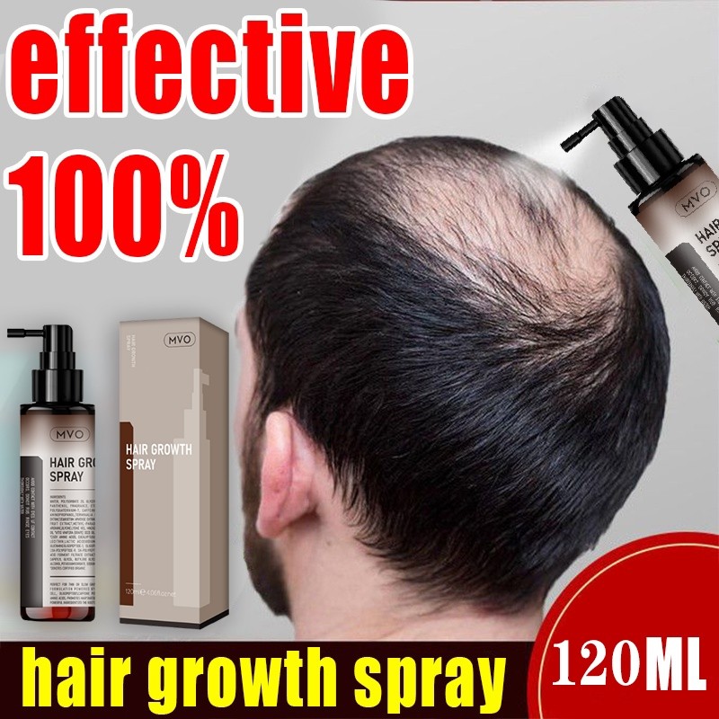 ♞MVO Novu Hair Grower Pomade For Men Original/Hair Growth Serum Oil ...