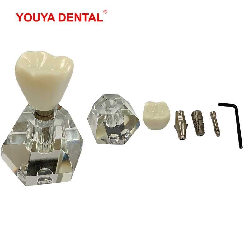 Dentist Crystal Tooth Implant Model Transparent Dental Implant Practice ...