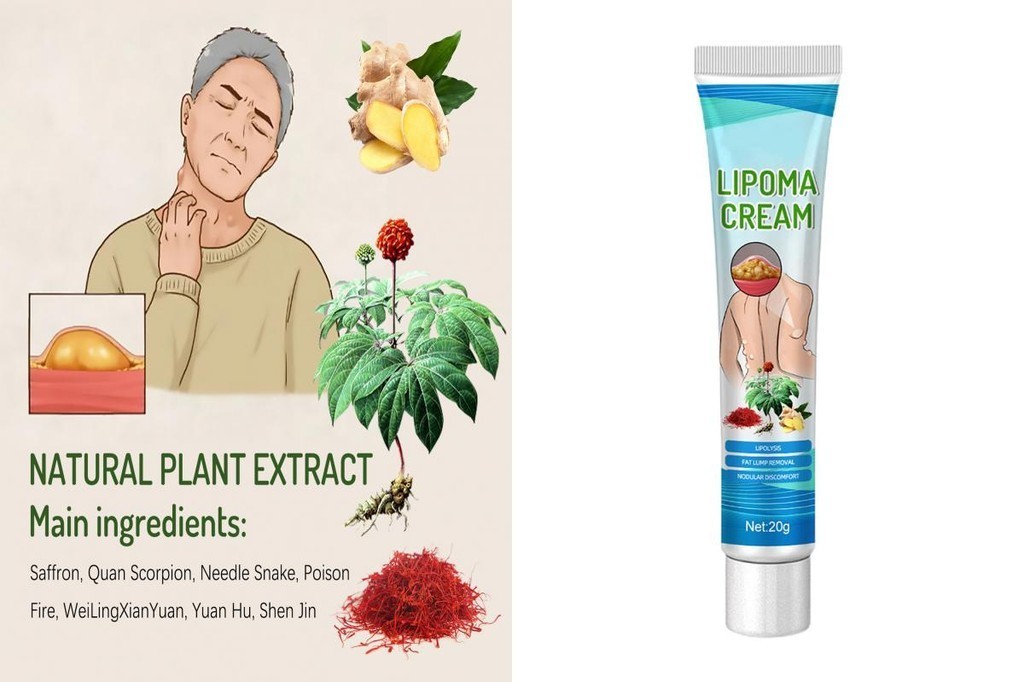 [Greaterbay] 20g Fatty Lump Cream Painless Unblocking Continuous ...