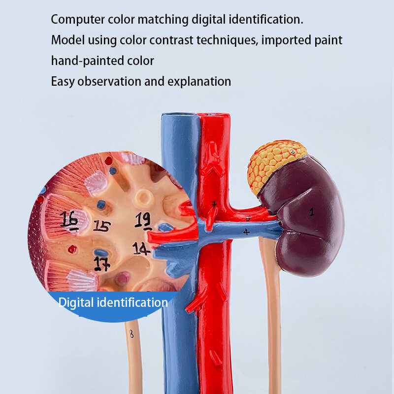 LY ♛ Human Urinary System Anmodel Kidney Ureter Bladder Urethra ...