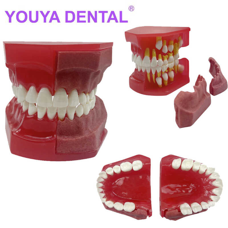 Dental Tooth Model Children Primary Permanent Tooth Model Removable ...