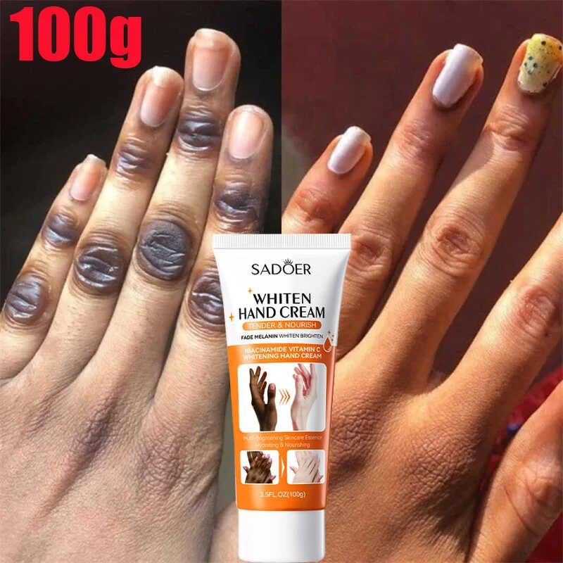 Hand cream Dark Knuckles Fast Whitening Anti Cracking Cream ...