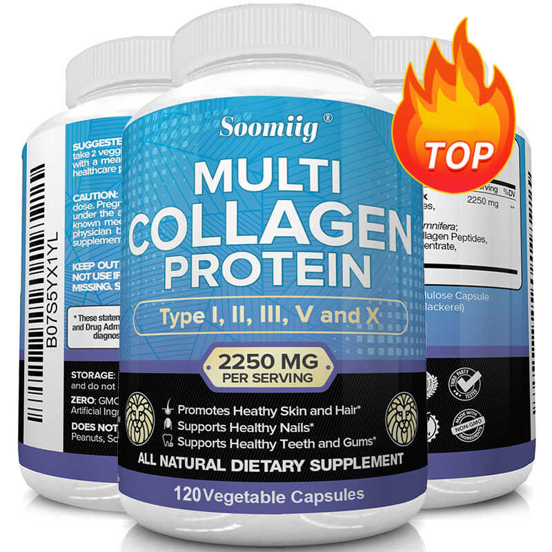 Collagen Supplement / Collagen Complex - Type I, II, III, V, X / Anti ...