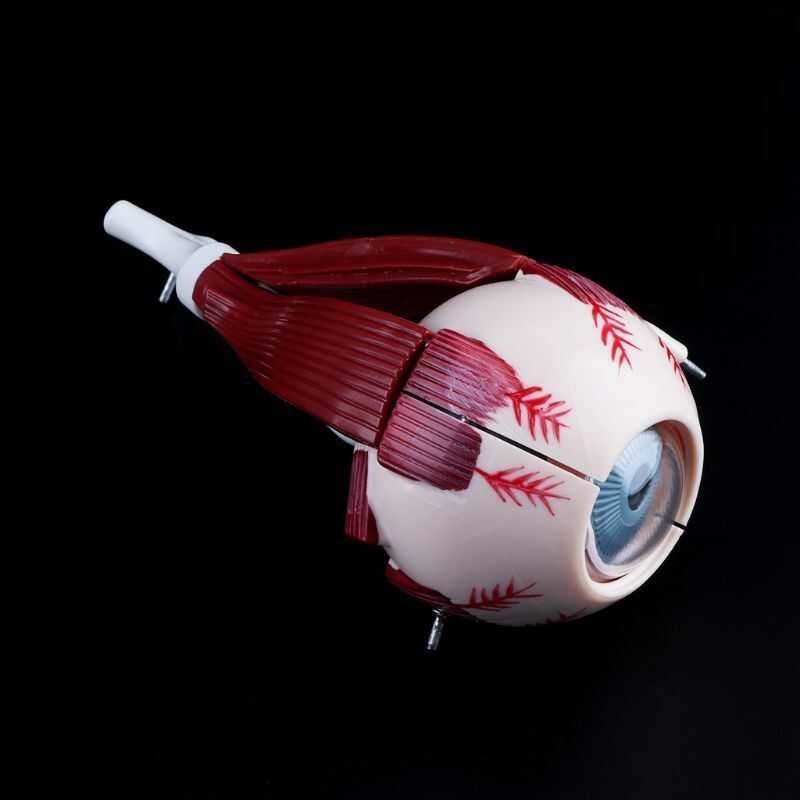 LY ♛ Enlarged Eyeball And Orbit Model Extraocular Muscle Optic Nerve ...