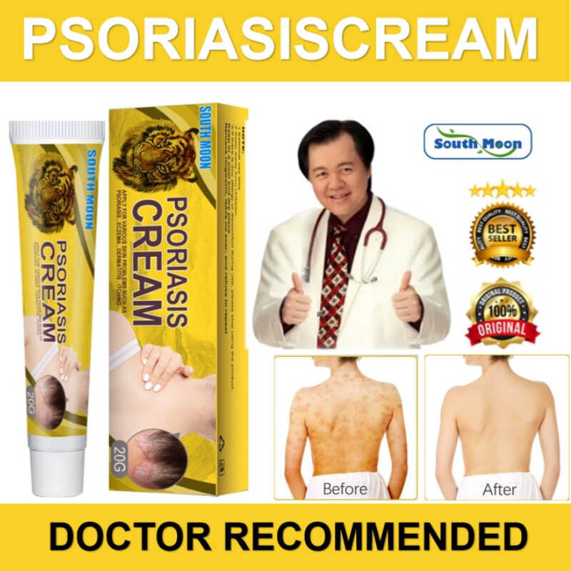 Psoriasis Cream Dermatitis Eczematoid Eczema Pruritus Ointment