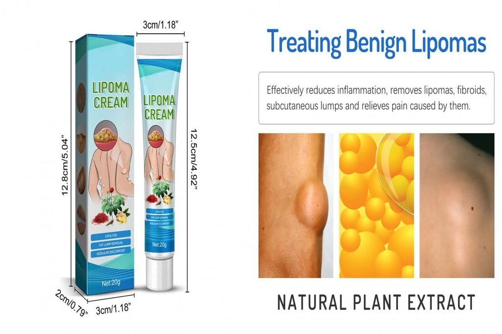 [Greaterbay] 20g Fatty Lump Cream Painless Unblocking Continuous ...