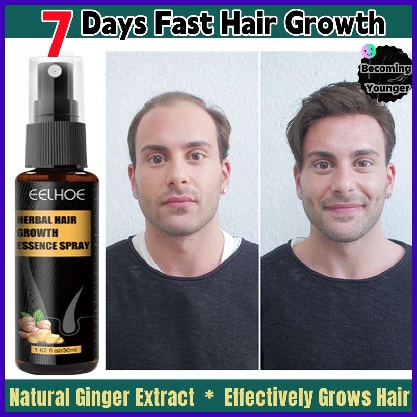 ¤ Fast Hair Growth Hair For Men Original Minoxidil Regrow Ginger Hair ...