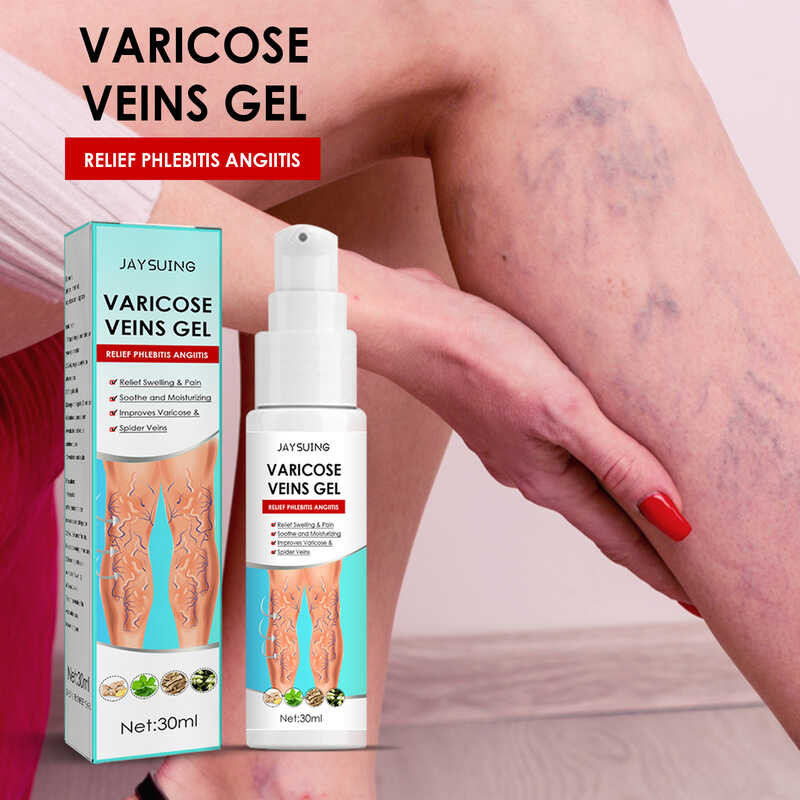 Jayswing Venous Massage Varix gel for Leg Pain Relief Earthworm Leg ...