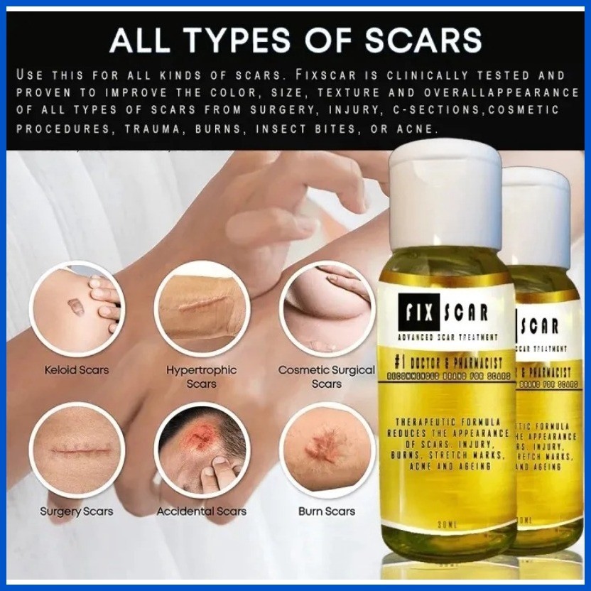 Original FixScar Removal Fix Scar Advance Gel Treatment (Para sa peklat ...