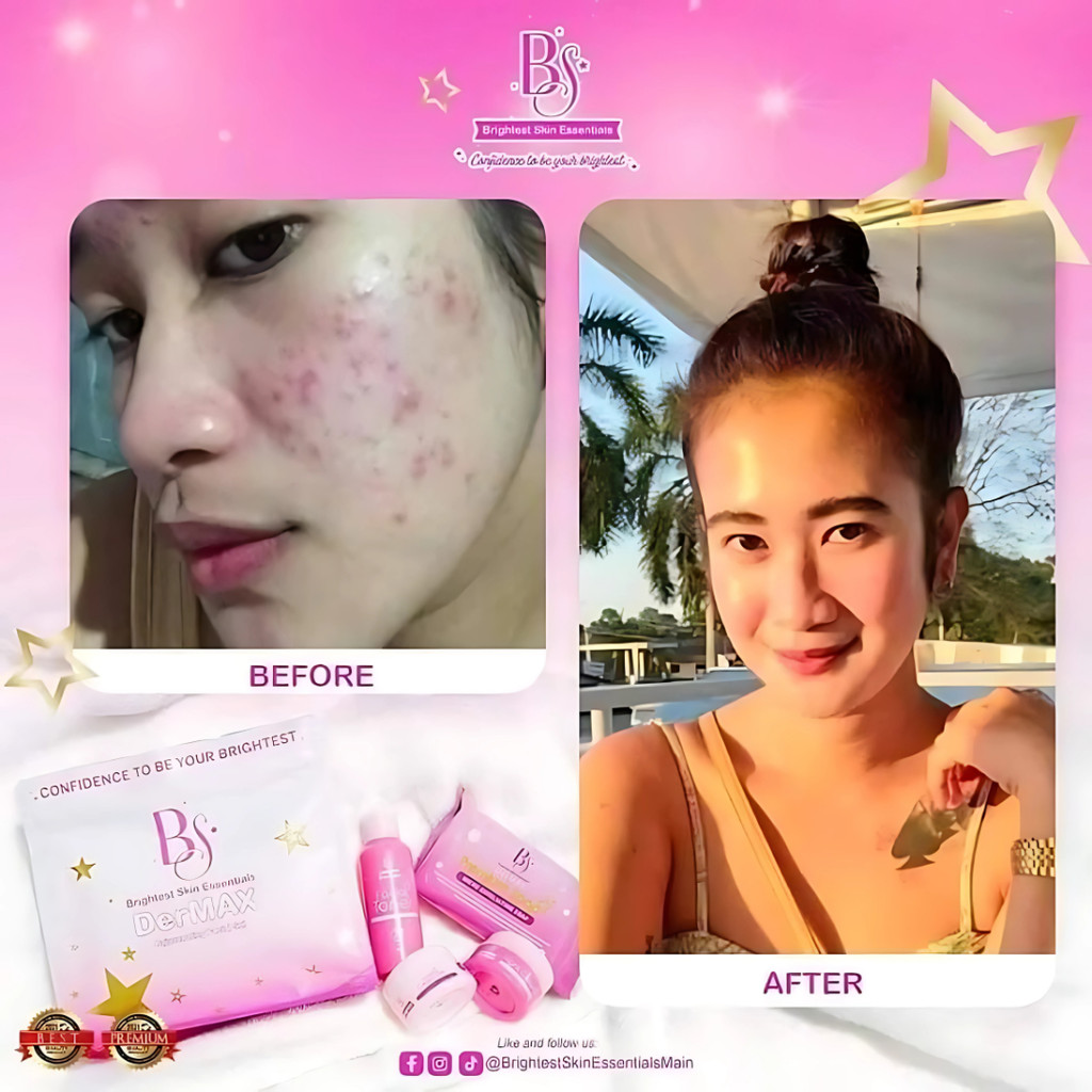 Brightest Skin Dermax Rejuvenating Facial Set | Shopee Philippines