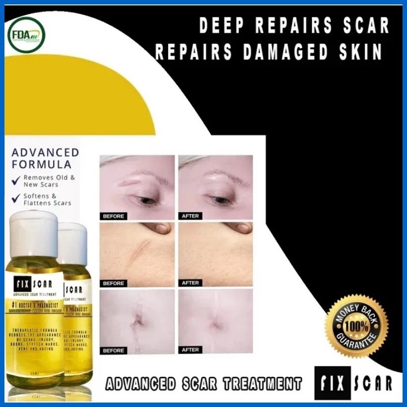 ♀ Original FixScar Removal Fix Scar Advance Gel Treatment (Para sa ...