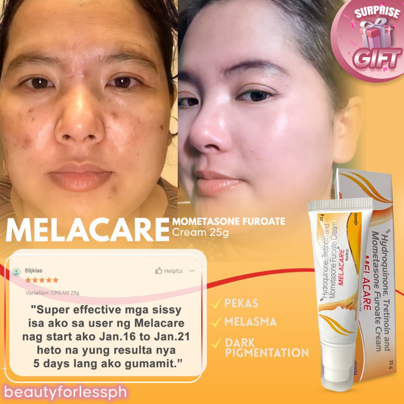 AUTHENTIC MelaCare Pekas remover dark spot pekas eraser melasma eraser ...