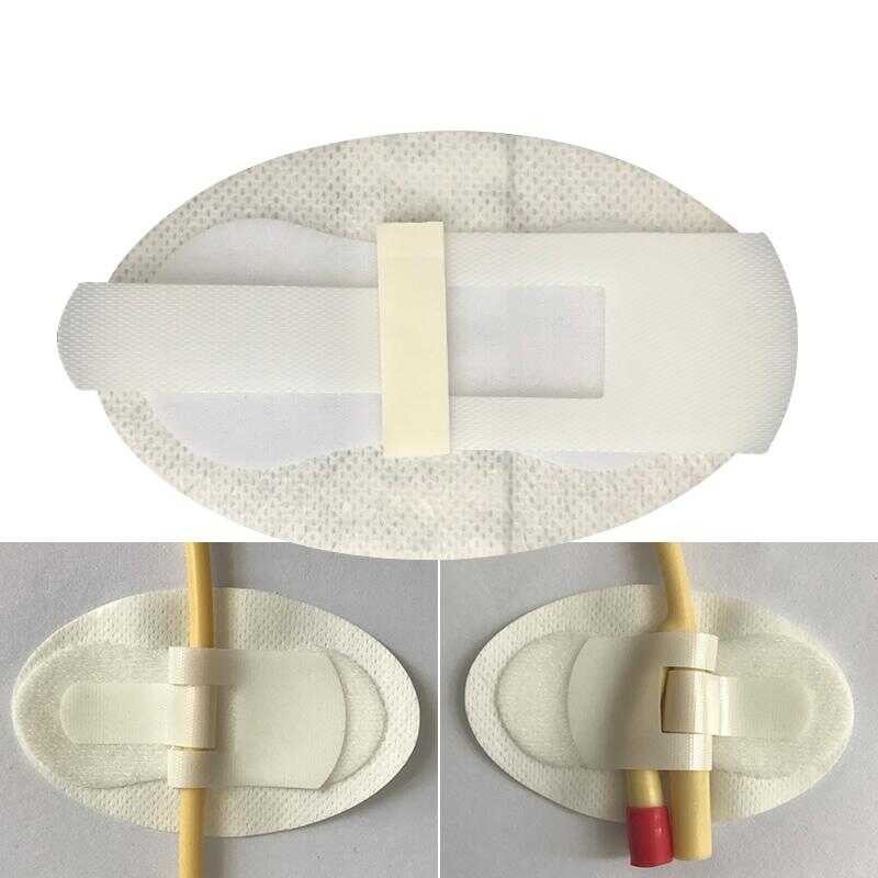 10Pcs Medical Body Surface Catheter Fixation Catheter Fixation Device ...