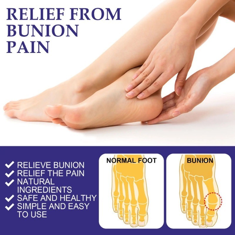 SouthMoon Anti Bunion Sticker Gout Pain Relief Lumbar Hallux Arthriti ...