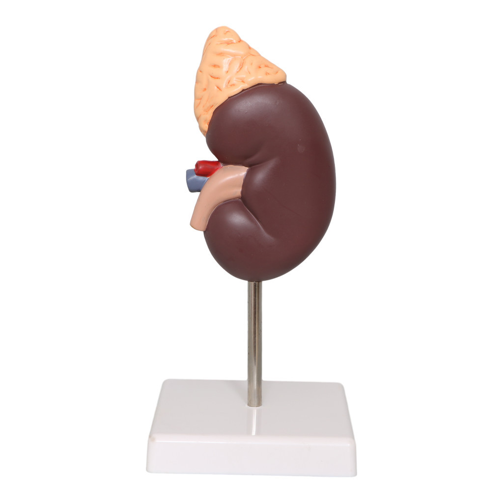 Anatomical model of the body, internal organs, diseases, kidney ...