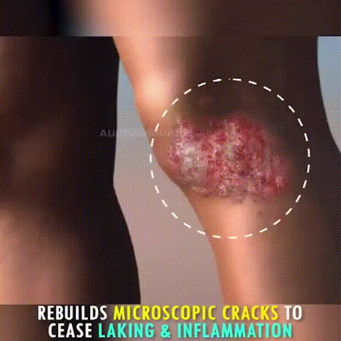 Psoriasis nemesis net cream | Shopee Philippines