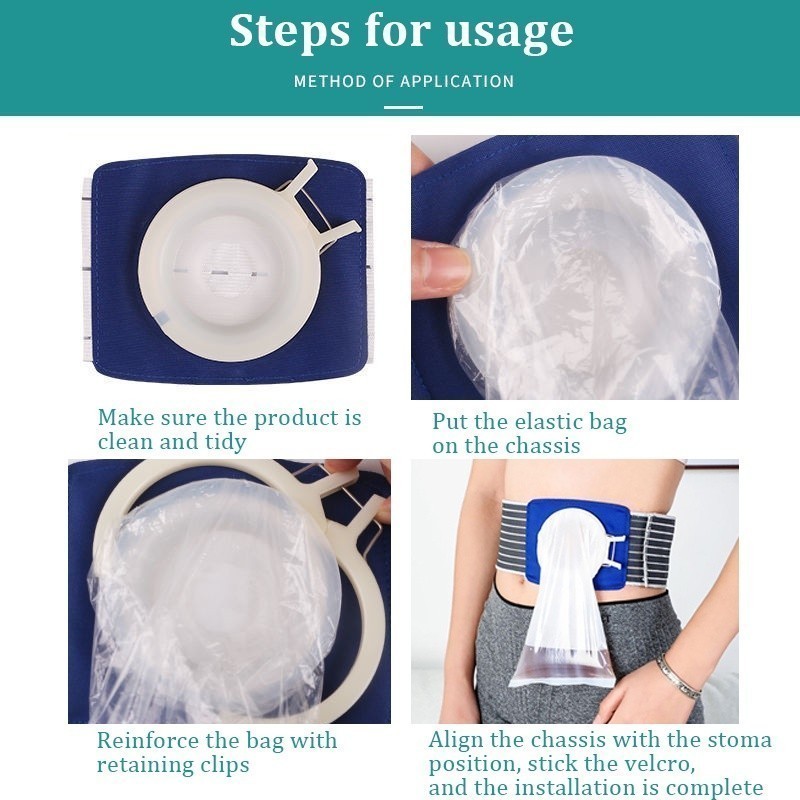 Disposable Banded Clear/Blue Stoma Bag, Ostomy Bag, Stoma Belt, Stoma ...