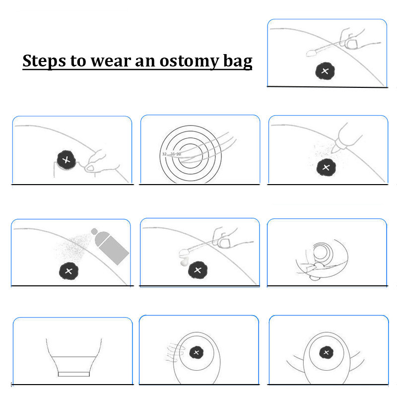 Ostomy Bag Scissors Stainless Steel Special Stoma Care Accessories ...