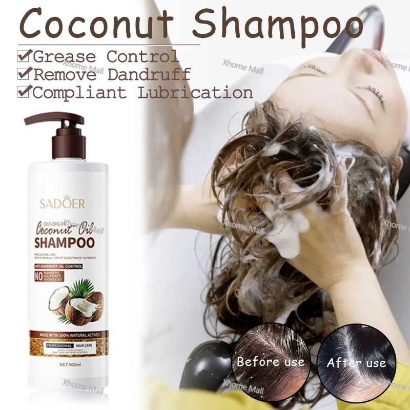 SADOER Coconut Anti Dandruff Moisturizing Refreshing Oil Control Shampoo, Fluffy Repair Frizz ...