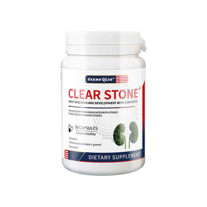 Stone Clear Tablets for Removing Stones, Gallstones for Removing Stones ...