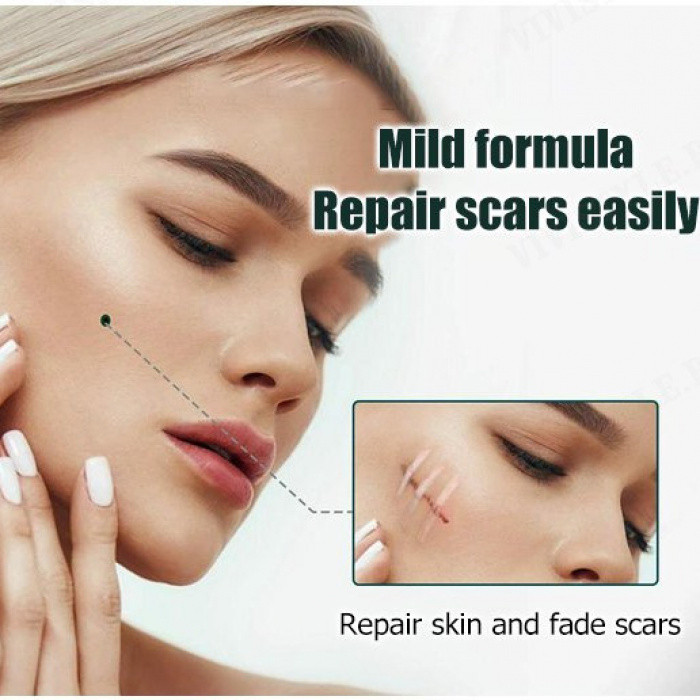 HBESTY 20g New scar removal cream remove scars without leaving marks ...
