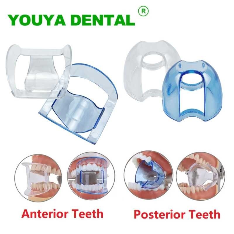 5Pcs Mouth Opener Dental Orthodontic Lip Cheek Retractor Expander Para ...