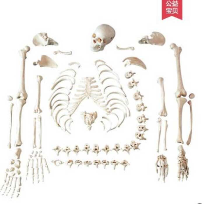 1:1 Human Whole Body Scattered Skeleton Model 170cm Human Scattered ...