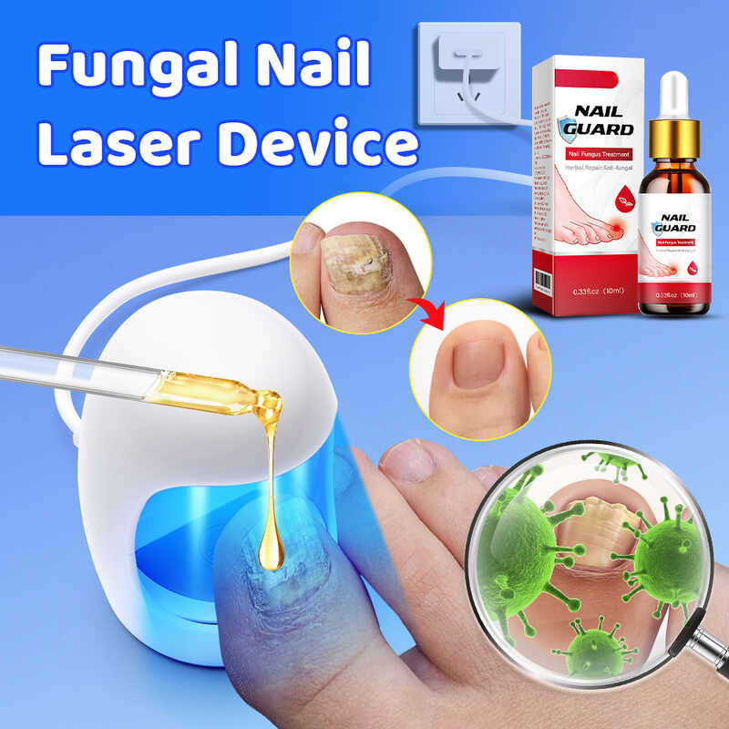Nail Laser Device Anti Infection Treat Fungus Therapy Paronychia ...