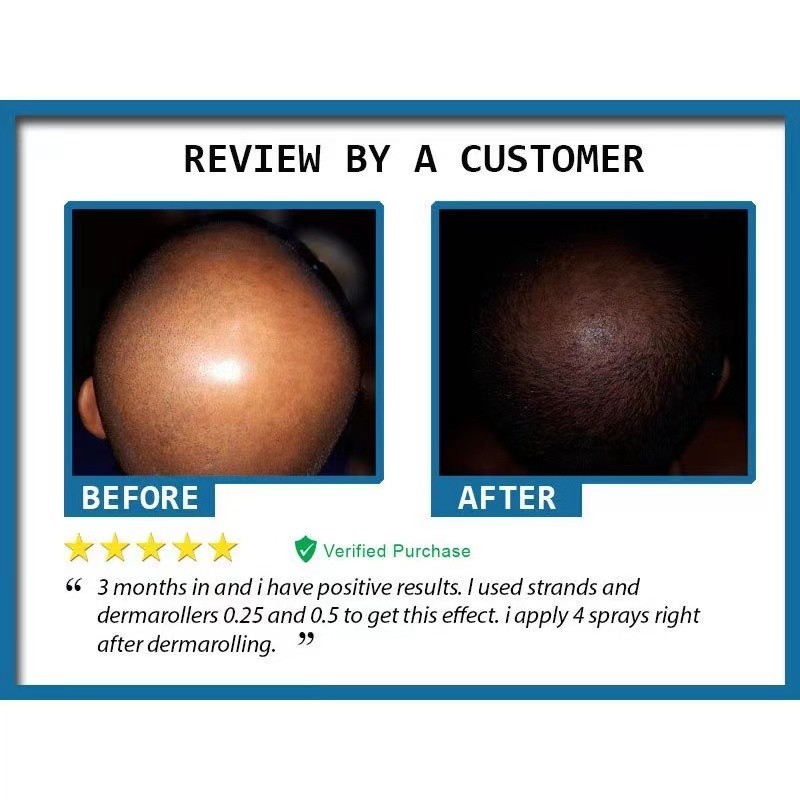 Men's Hair Spray Hairline Protection Helps To Grow Thick and Long Hair ...