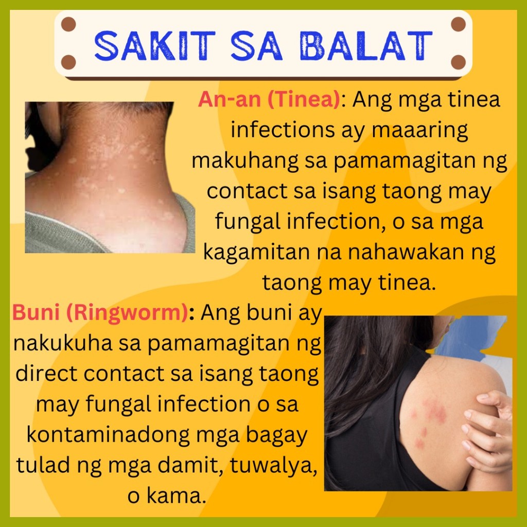 ∩ ☸ Anti fungal Kasoy Medicinal Soap for Sensitive Skin | Sabon sa Kati ...