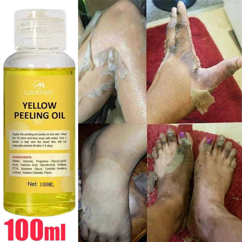 Care Body Exfoliating Yellow Peeling Oil 100% Organic Bleaching Skin ...