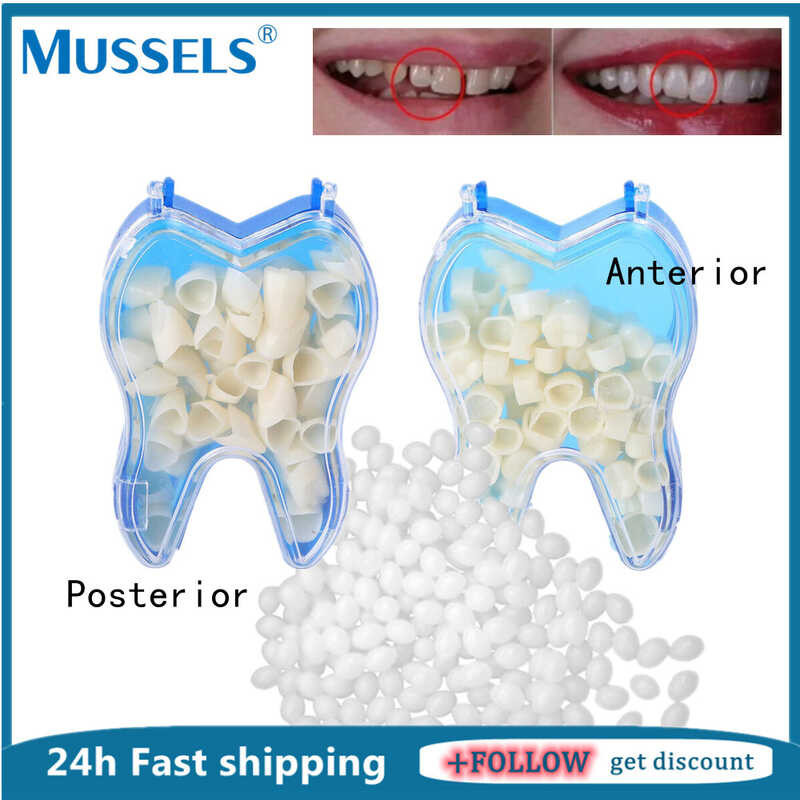 Dental Crown Teeth Veneers Temporary Repair Denture Tooth Cap Resin ...