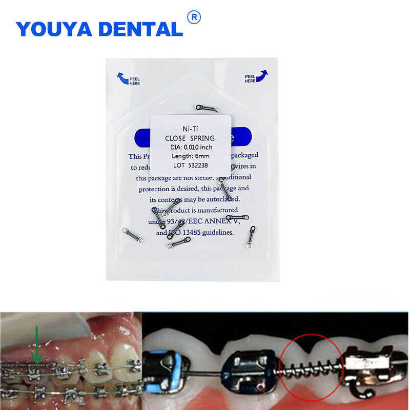 1 Pack Dental Orthodontic Niti Isara Ang Pull Ring Torque Spring ...