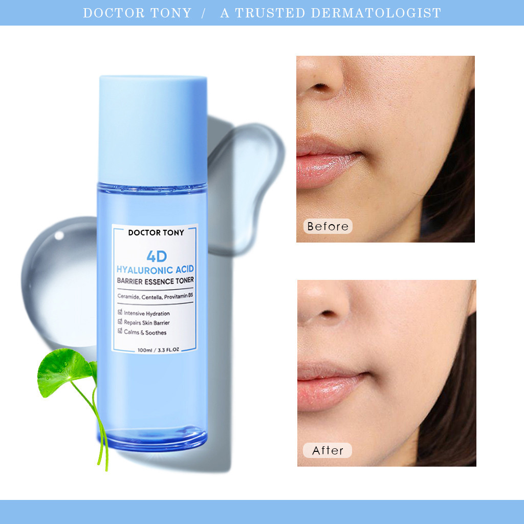 DOCTOR TONY 4d Hyaluronic Acid Barrier Essence Toner Hydrating Toner ...