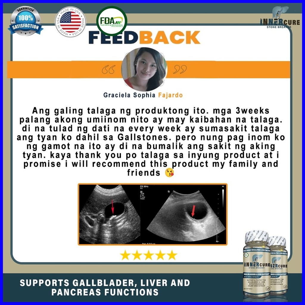 Innercure by Liza Ong and Willie Ong - Dissolved Gallstones - Removed ...
