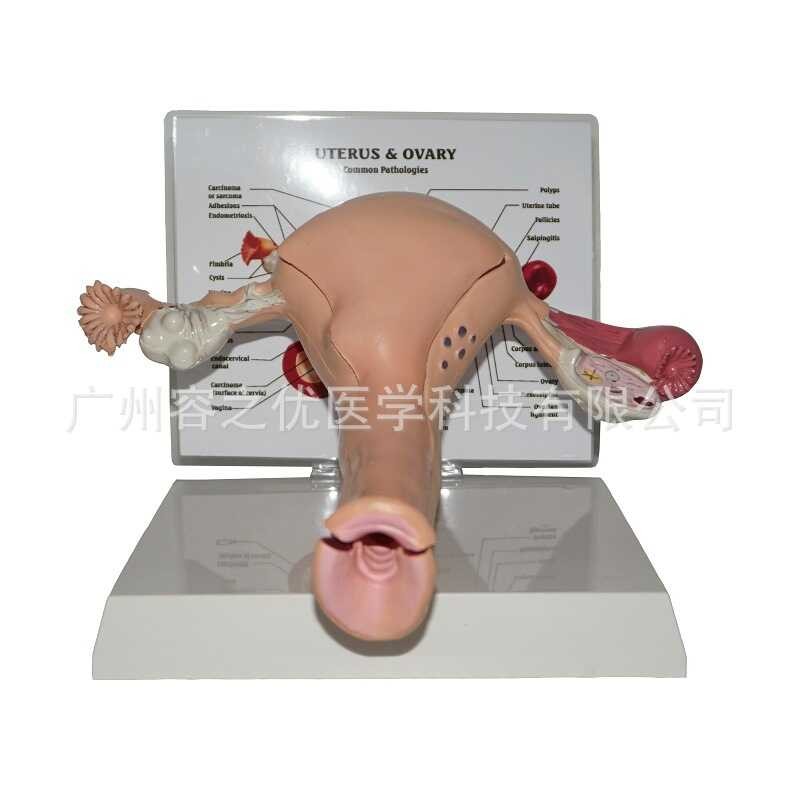 Uterine Model Anatomy Uterine Teaching Model Pathological Uterine Model ...