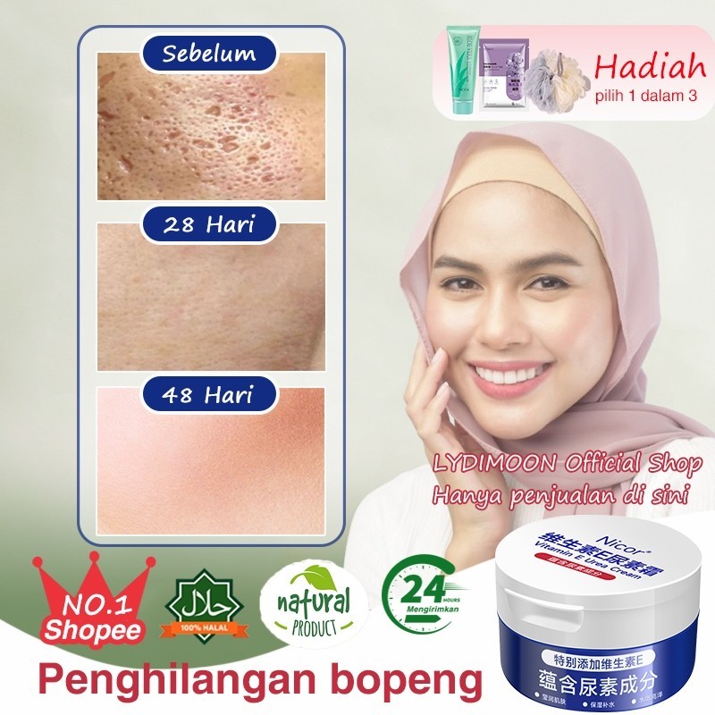 scar remover facial cream 100g acne hole medicine pockmark remover ...