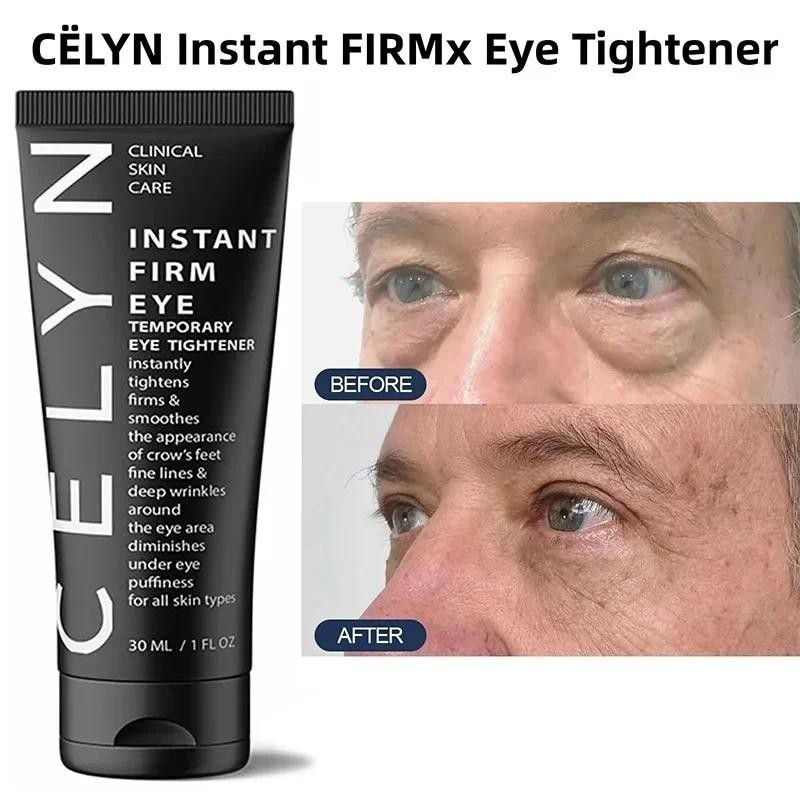 CELYN 30ml Instant Firm Eye Cream Reduce Fine Lines and Dark Circles ...