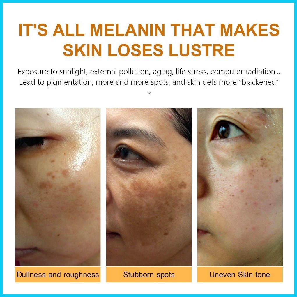 HEMEIEL Super Collagen Melasma Cream/24k Gold Melasma Cream/Kasumi ...