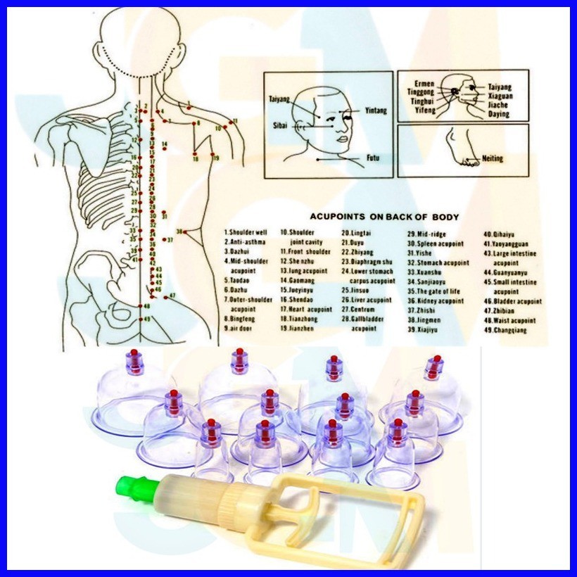 ☂ Khyrie Store | Traditional Ventosa Cupping Machine | Cupping Therapy ...
