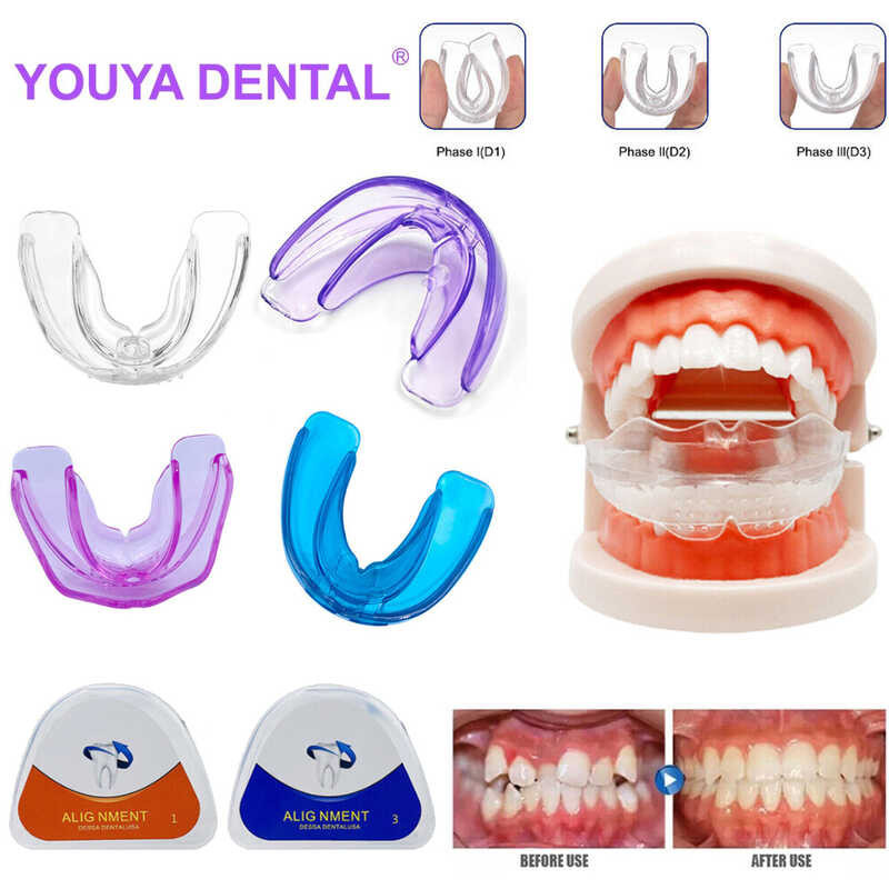 Dental Tooth Orthodontic Appliance Adults Aligner Alignment Braces ...