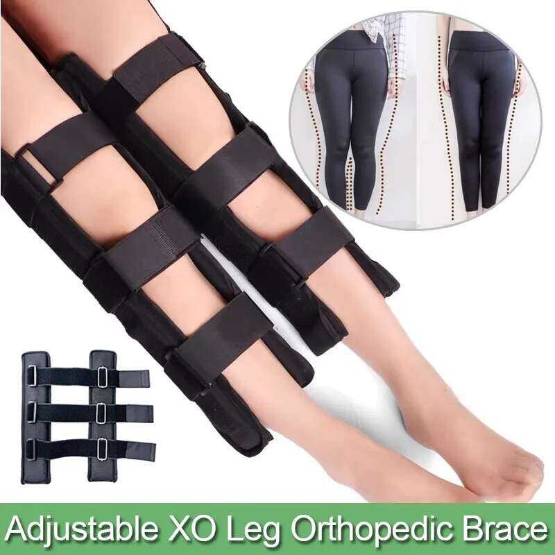 O Type Adjustable Bow Effective Leg Correction Belt-Knee Valgum ...