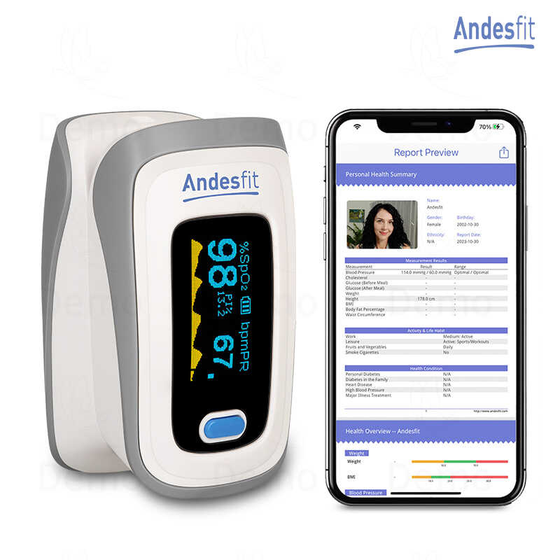 Digital Bluetooth Wireless Transmission Fingertip Pulse Digital ...