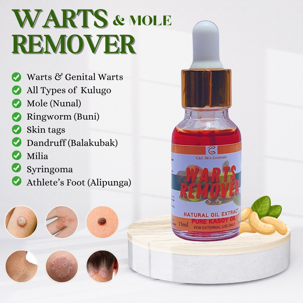Original Kasoy Oil warts and skin tag remover 15ML | Shopee Philippines