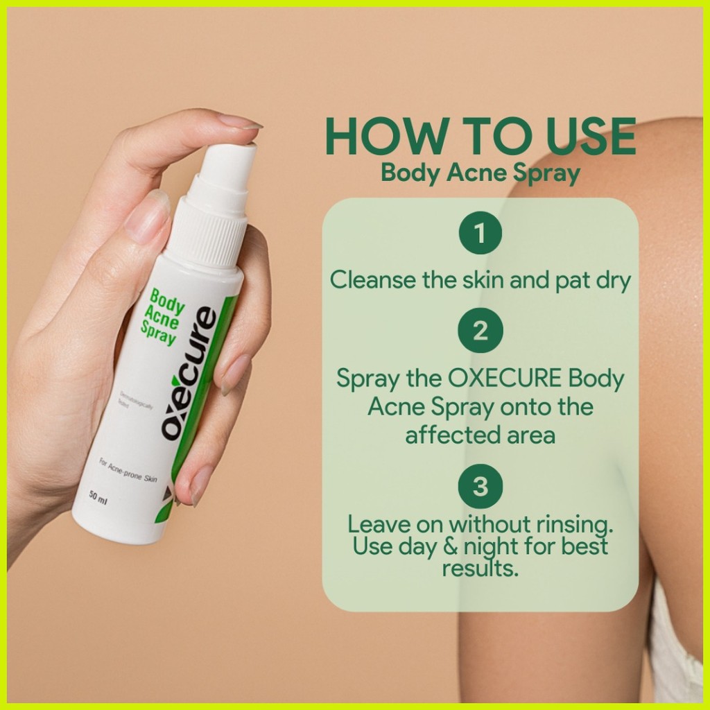 ♣ ☑ OXECURE 2% Salicylic Acid Body Acne Spray 50ml | Shopee Philippines