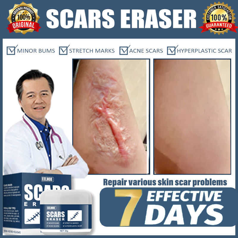 Fix Removal Original For Old Scars Gel Willie Remover Fixscar By Doc ...