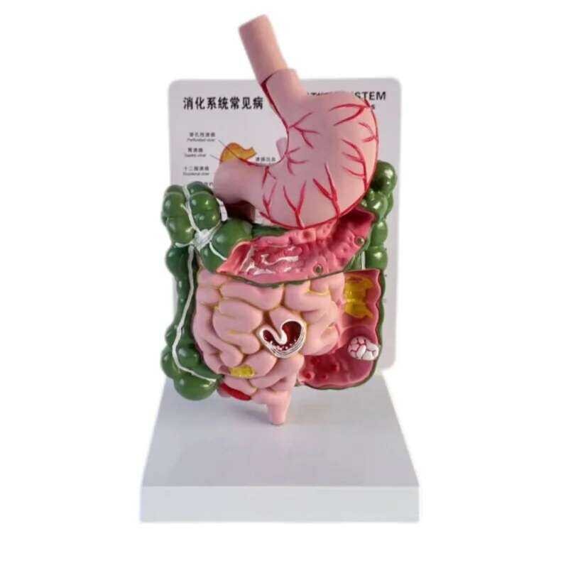 Medical Teaching Model Of Human Digestive System And Large Intestine ...