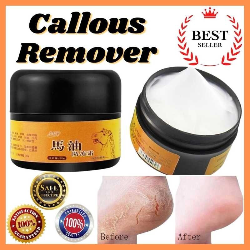 Mga 2024 COD Effektibong Calluses Kalyo Removal para sa Foot, Callous ...